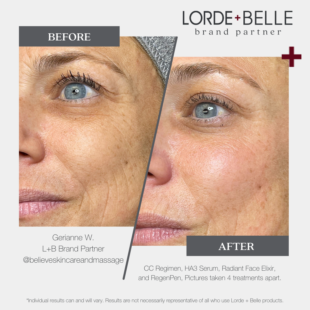 Rejuvenating Your Lips and Mouth: Say Goodbye to Dry Skin – LORDE AND BELLE