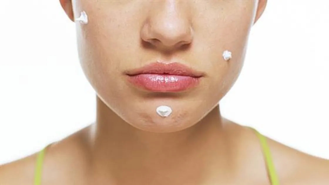 Possible Reasons for Skin Breakouts from Cosmetics – LORDE AND BELLE