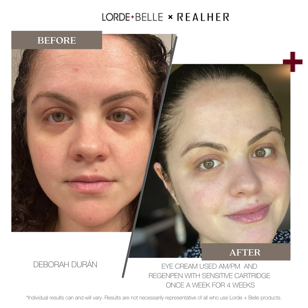 Embracing Freeze-Dried Skincare: The Trend Taking the Beauty World by ...